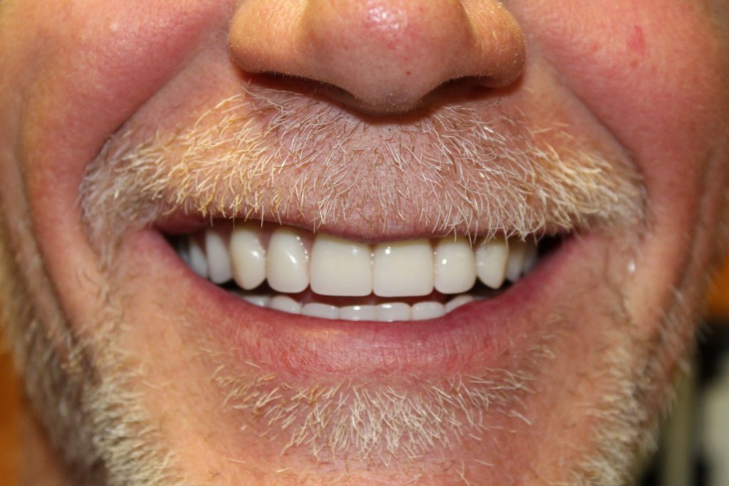 Gallery – Kevin Hintz DDS